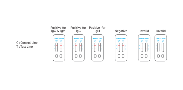 TYPHOID Rapid IgG/IgM (Combo) Test - Reszonics