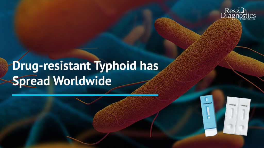 Drug-resistant Typhoid has Spread Worldwide - Reszonics